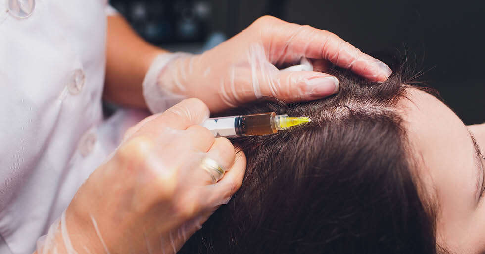 Plasma Injections for Hair Loss: What you need to know | Femina.in