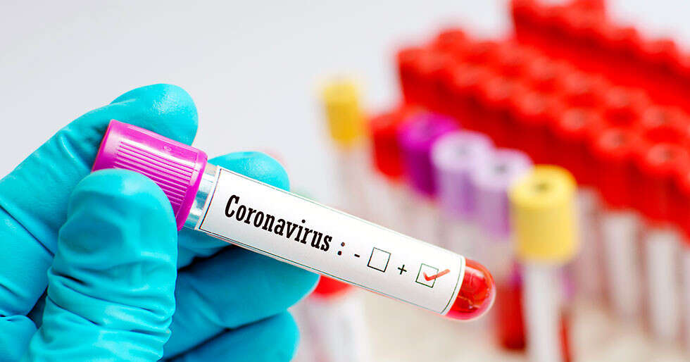 Protective Measures You Must Take Against Coronavirus | Femina.in