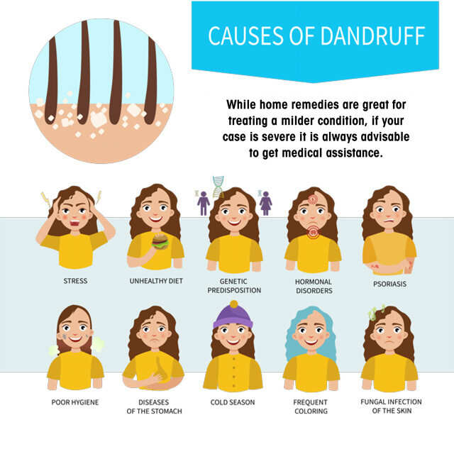 Best Natural Dandruff Treatments At Home