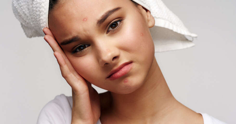 Prevent Breakouts Quickly With These Tips | Femina.in