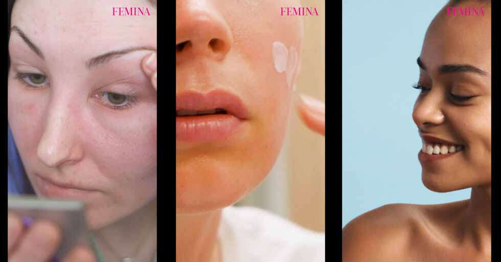 Benefits Of Vitamin C For Skin