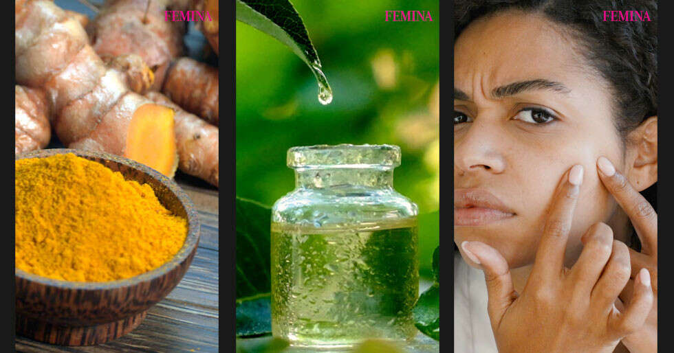Treat Acne With Home Remedies