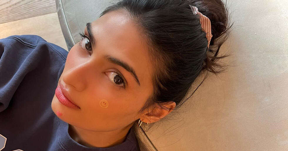 7 Best Face Masks to Reduce Acne Scars