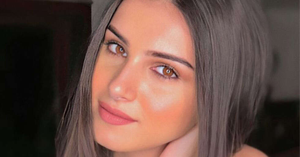 Lip Pigmentation Care: Simple Daily Steps That Fade Darkness | Femina.in