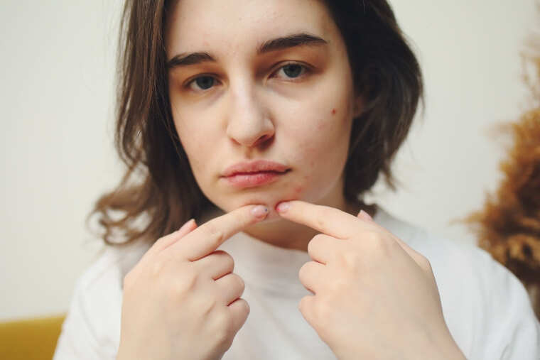 Are You Over-Exfoliating Your Skin? Common Mistakes People Make With ...