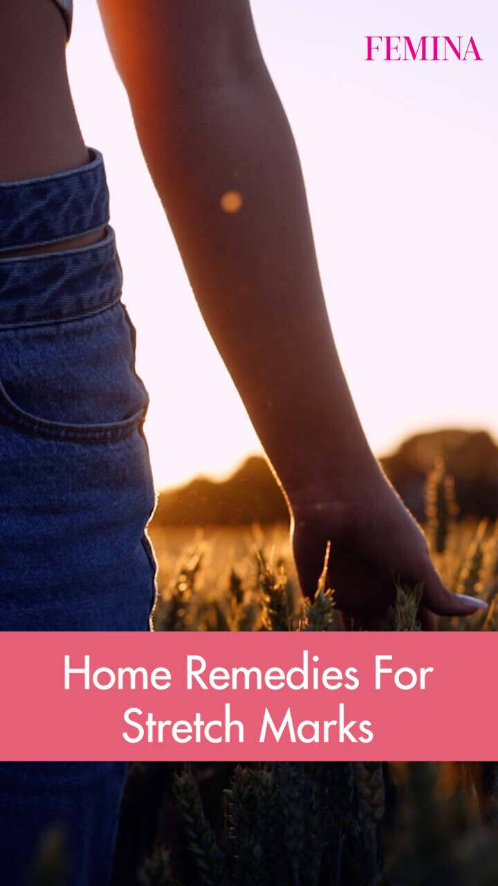 5 Home Remedies For Stretch Marks Removal